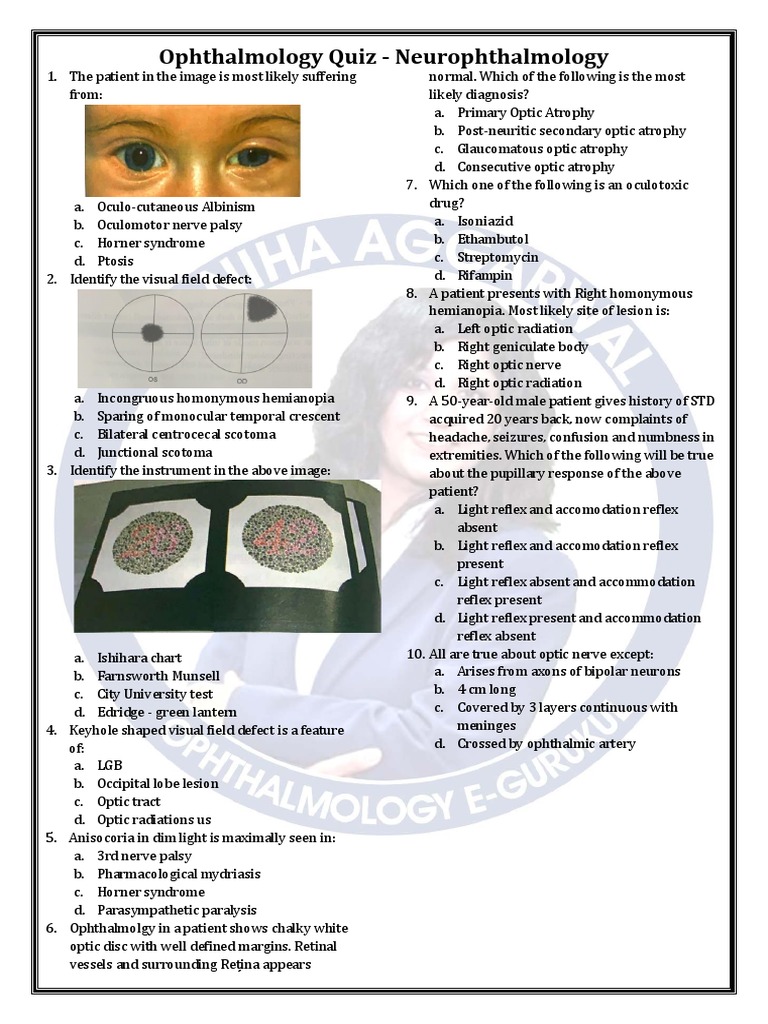 Ophtha Quiz - Neurophthalmology | PDF | Nerve | Retina