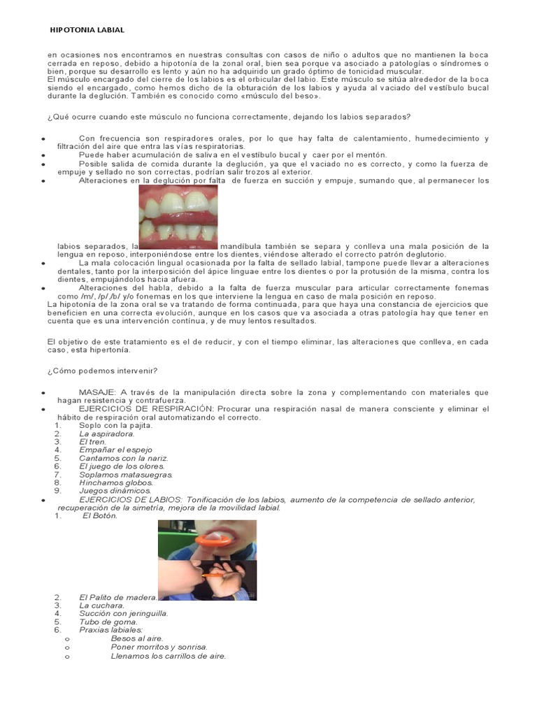 Hipotonia Labial | PDF | Especialidades Medicas | Bienestar