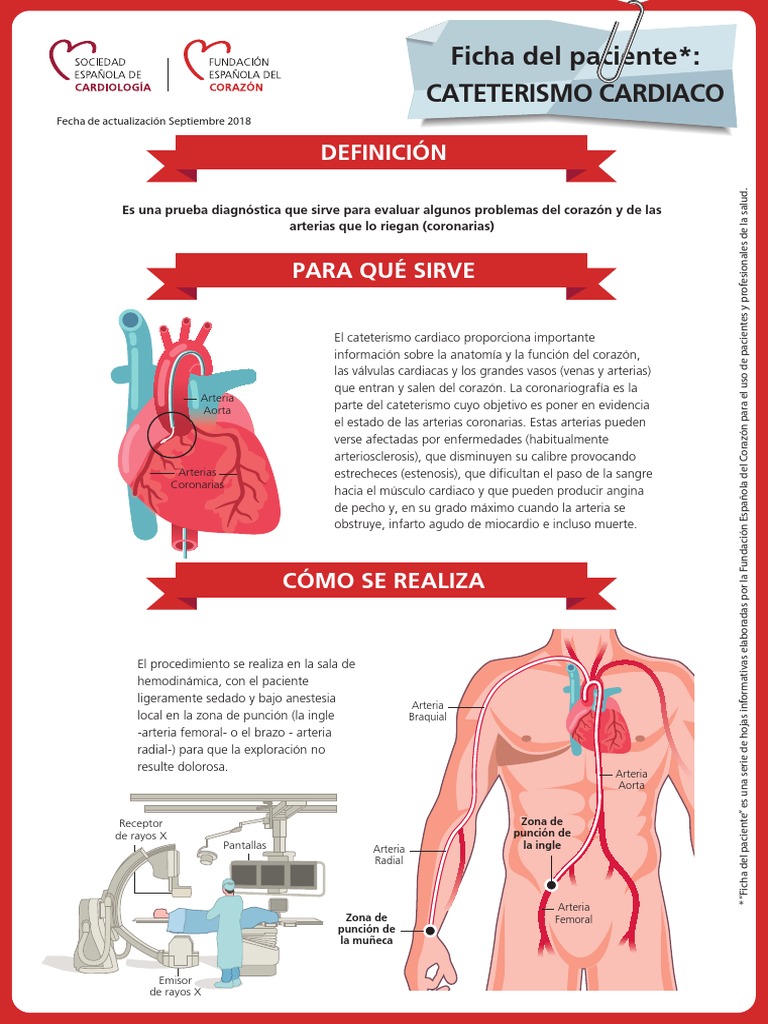 Cateterismo Cardiaco PDF | PDF | Corazón | Infarto de miocardio