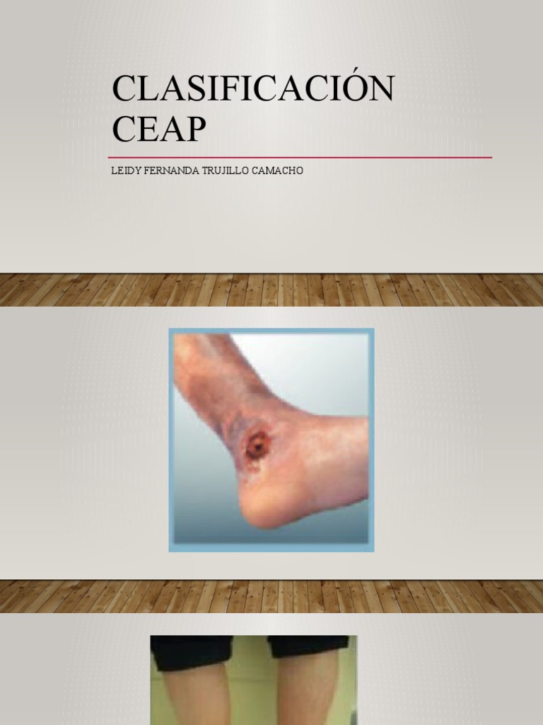 Clasificación Ceap | PDF