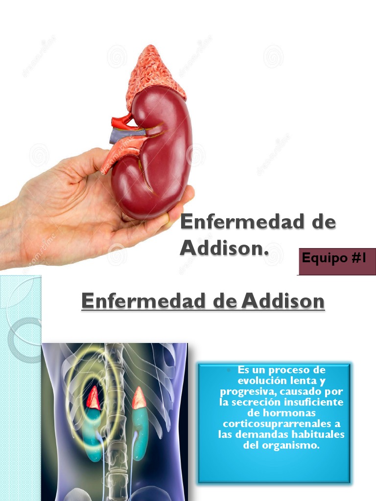 Enfermedad de Addison-Diapositiva | PDF | Glándula suprarrenal | Hormona adrenocorticotrópica
