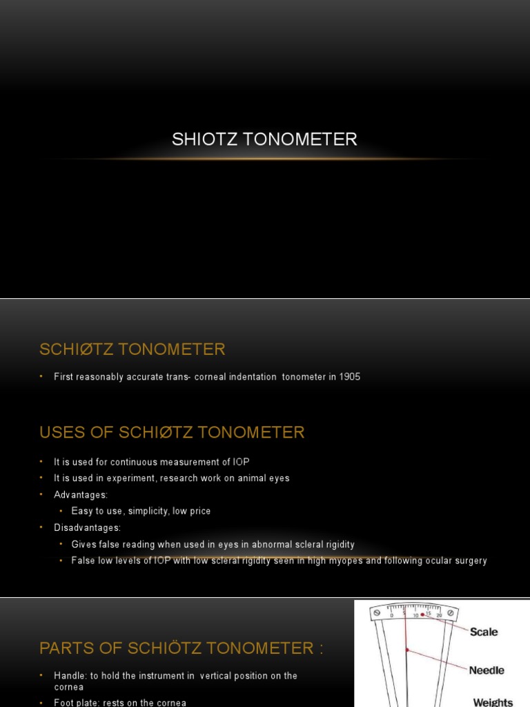 Shiotz Tonometer - Updated | PDF | Eye | Human Eye