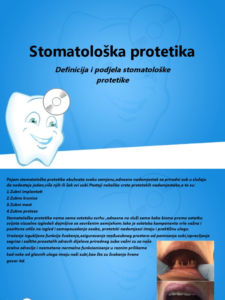 Elmin | PDF