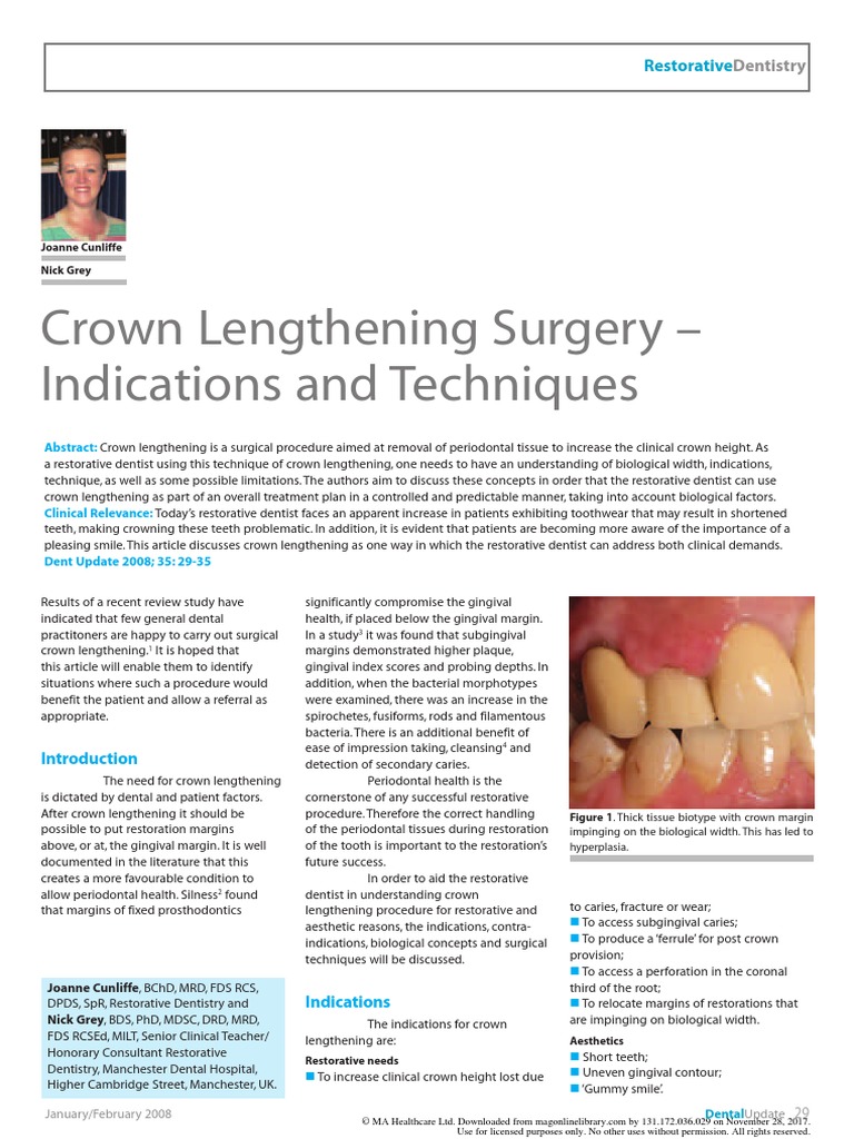 Crown Lengthening Surgery - Indications and Techniques: Restorative ...