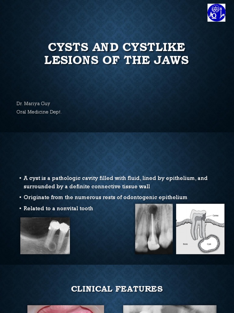 Cysts | PDF | Animal Anatomy | Dentistry Branches