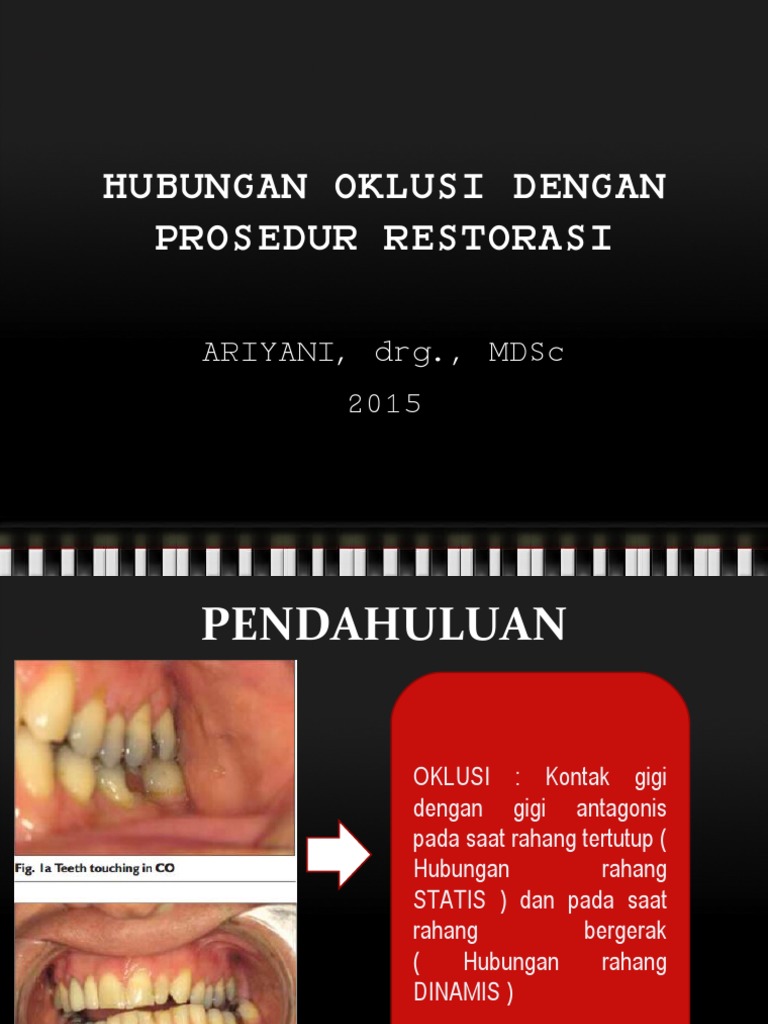 Oklusi dalam Prosedur Restorasi Gigi | PDF