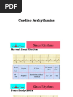 Ecg Made Easy | PDF | Electrocardiography | Circulatory System
