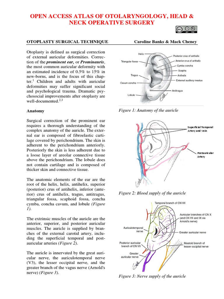 Otoplasty Techniques and Surgical Steps | PDF | Human Anatomy | Human ...