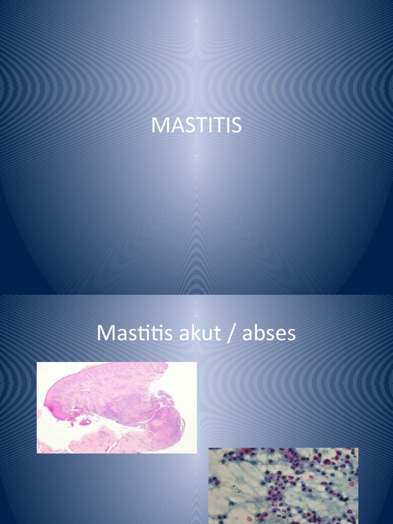 MASTITIS | PDF | Kesehatan Holistik | Sains & Matematika