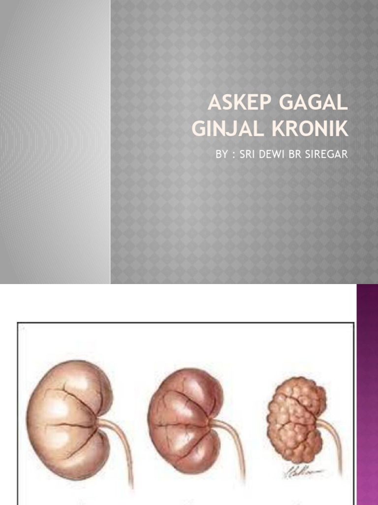 Askep Gagal Ginjal Kronik | PDF