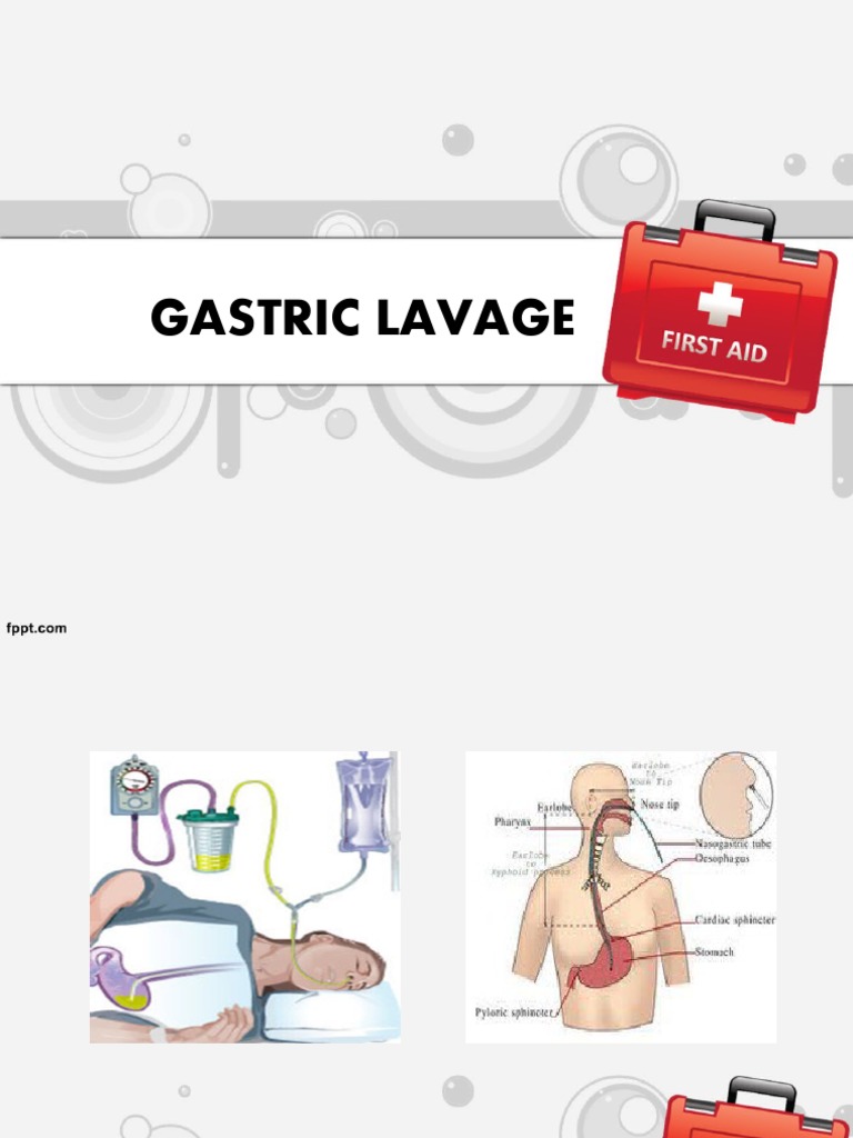 Gastric Lavage | PDF