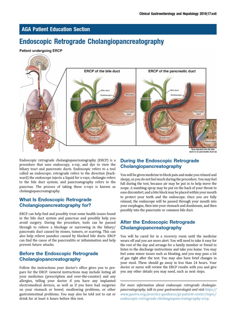 Ercp - PDF | PDF | Endoscopy | Gastroenterology