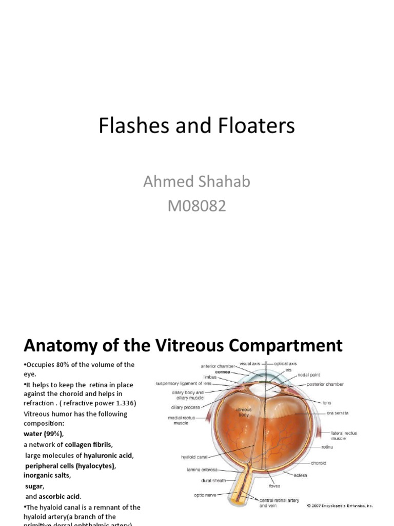 Flashes and Floaters: Ahmed Shahab M08082 | PDF | Diseases Of The Eye ...