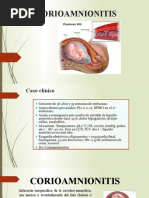 Infeccion Por Corioamnionitis 248892 Downloable 675163 | PDF | El ...