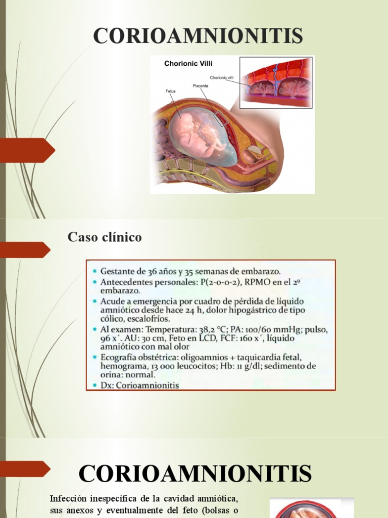 CORIOAMNIONITIS | Descargar gratis PDF | El embarazo | Parto
