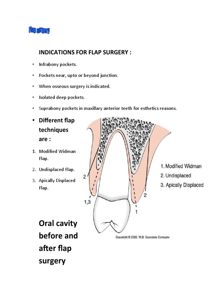 Oral Cavity Before and After Flap Surgery | PDF