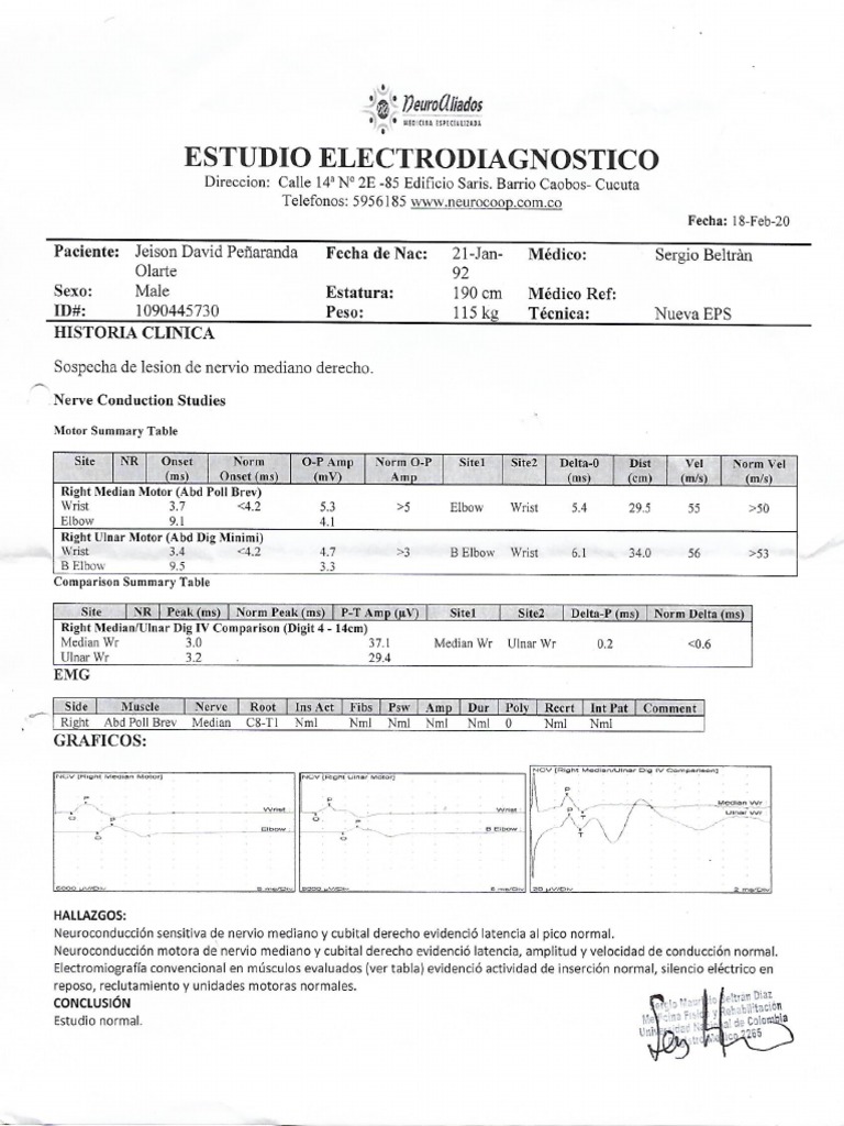 Electromiografia | PDF