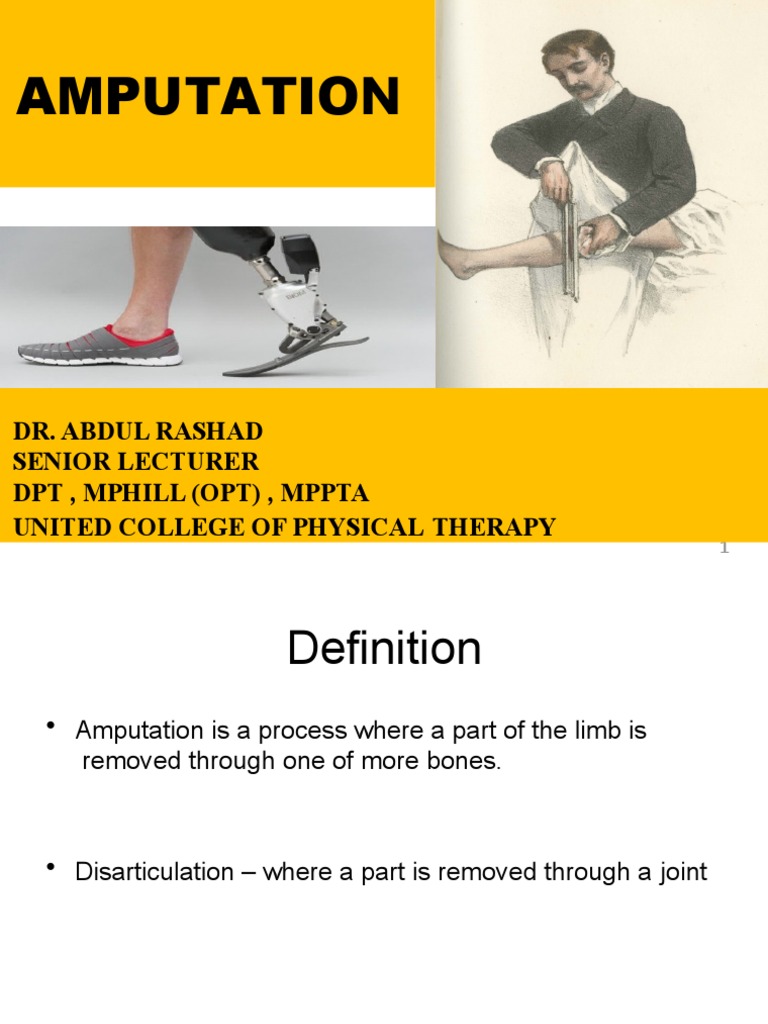 Amputation: Dr. Abdul Rashad Senior Lecturer DPT, Mphill (Opt), Mppta ...
