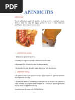 Signos Clínicos para Diagnóstico de Apendicitis | PDF | Medicina ...