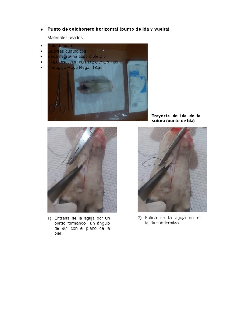 Punto de Colchonero Horizontal | PDF | Cirugía | Especialidades Medicas