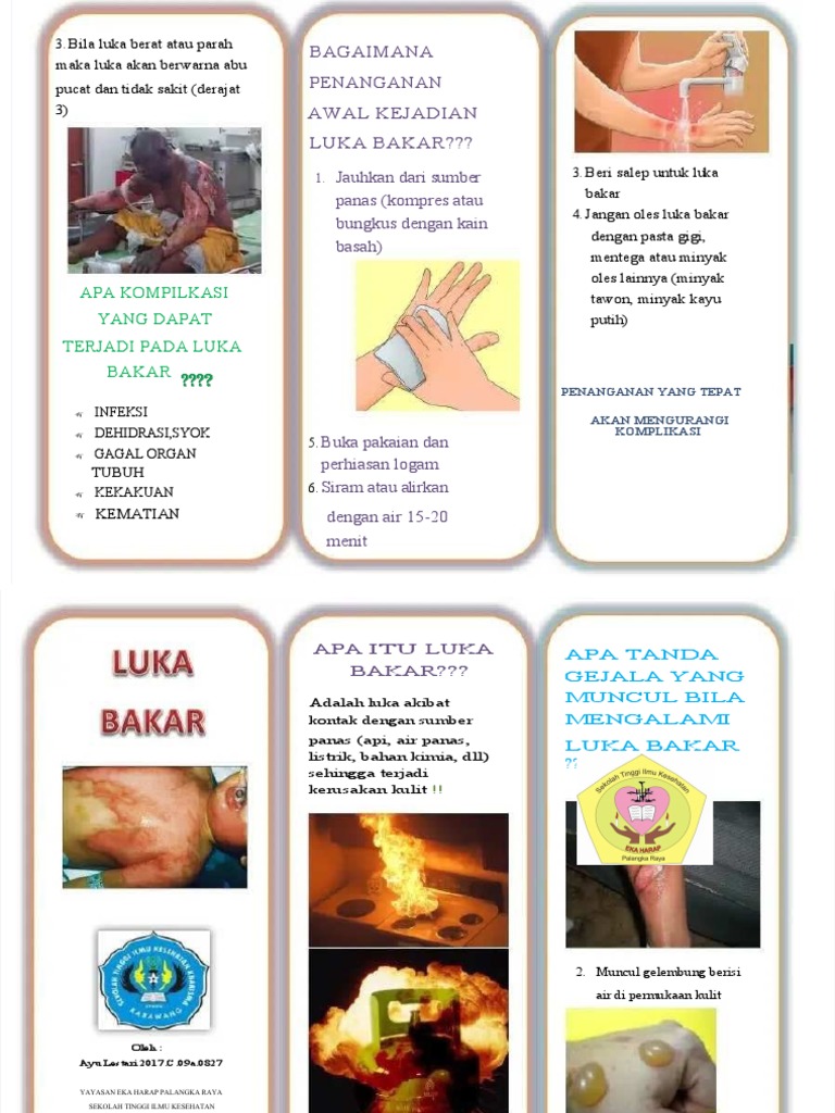 PDF Leaflet Penanganan Luka Bakar | PDF