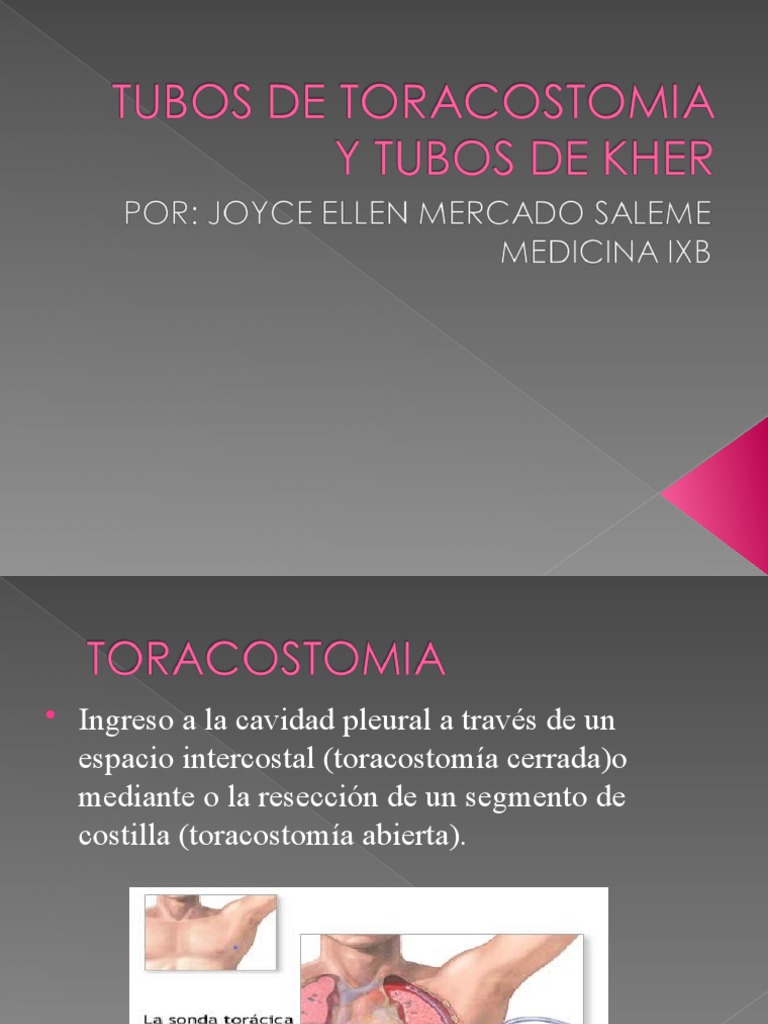 Comparativa de Toracostomía y Coledocotomía | PDF | Gastroenterología ...