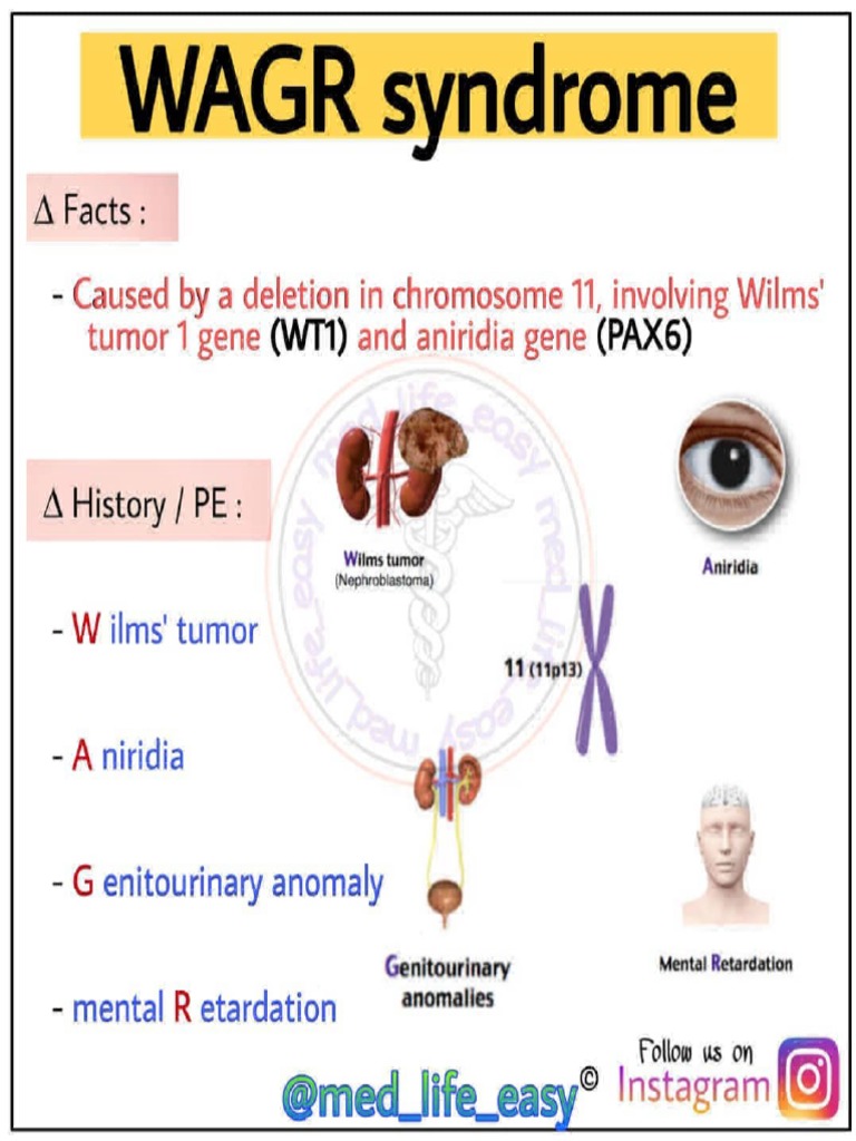 WAGR syndrome