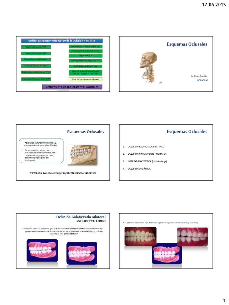 Esquemas Oclusales y Contactos Clave | PDF | Anatomia dental | Anatomía ...