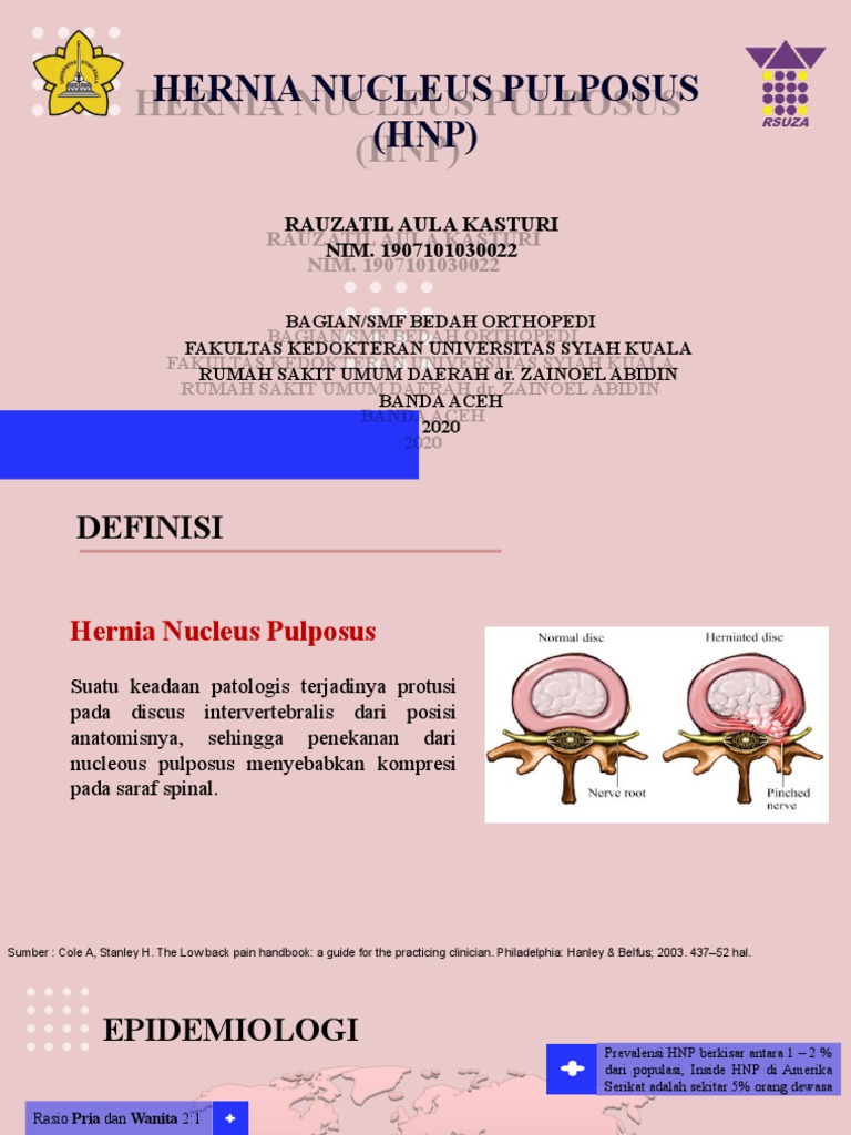 Hernia Nucleus Pulposus (HNP) | PDF