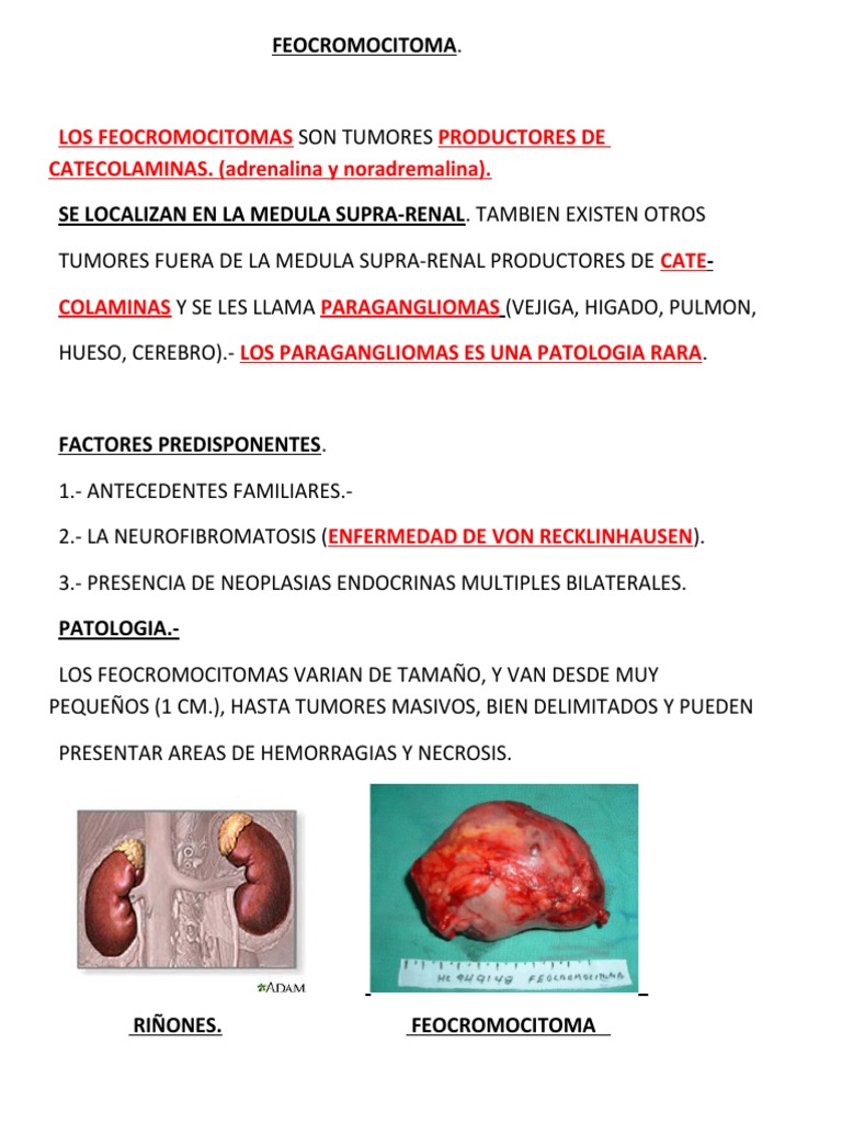 10 Feocromocitoma | PDF | Ciencia y matemáticas