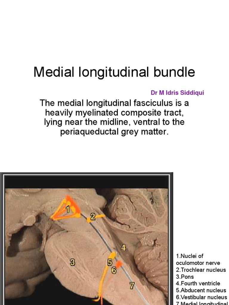 Medial Longitudinal Fasciculus Anatomy
