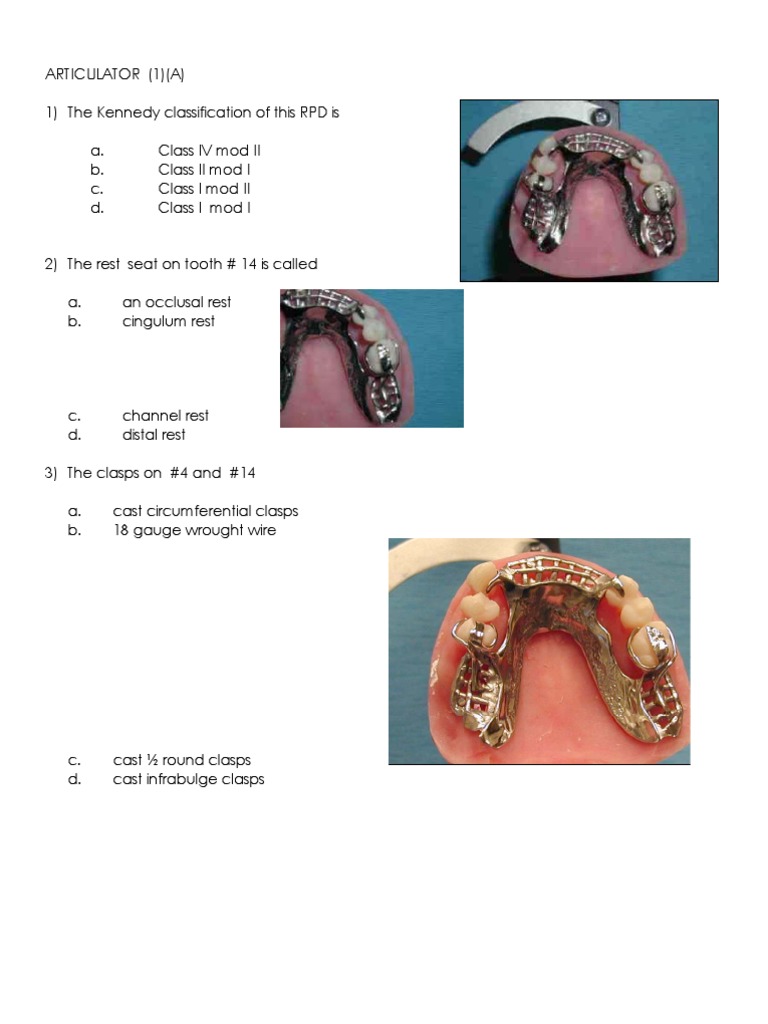 rpd | Dentures | Mouth | Free 30-day Trial | Scribd