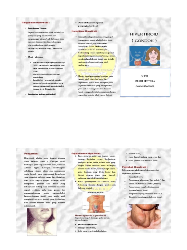 Leaflet Hipertiroid | PDF