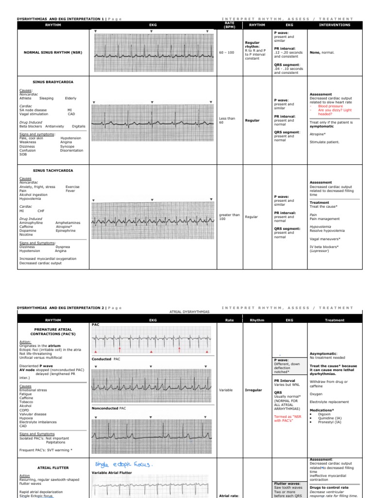 Rhythm EKG Rate (BPM) Rhythm EKG Interventions | PDF ...