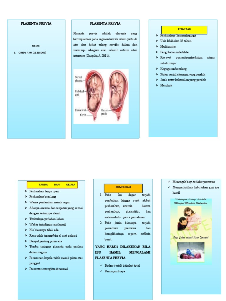 Leaflet Plasenta Previa | PDF