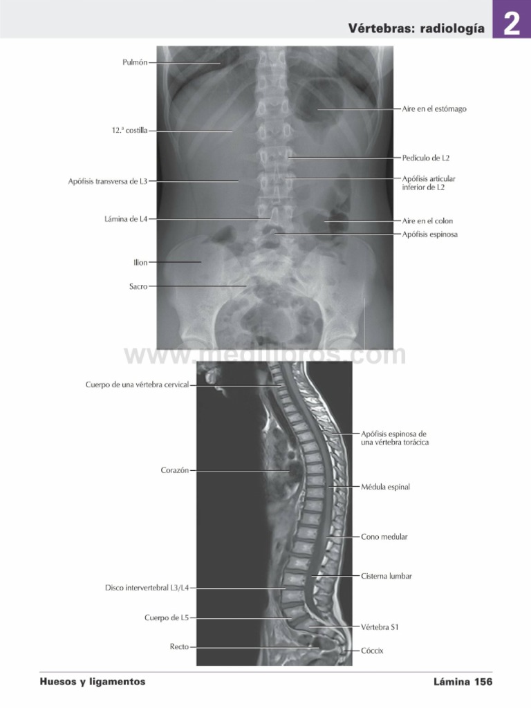 Atlas de Anatomia Humana Netter 6ed Medilibros - Com 91 | PDF | Tórax ...