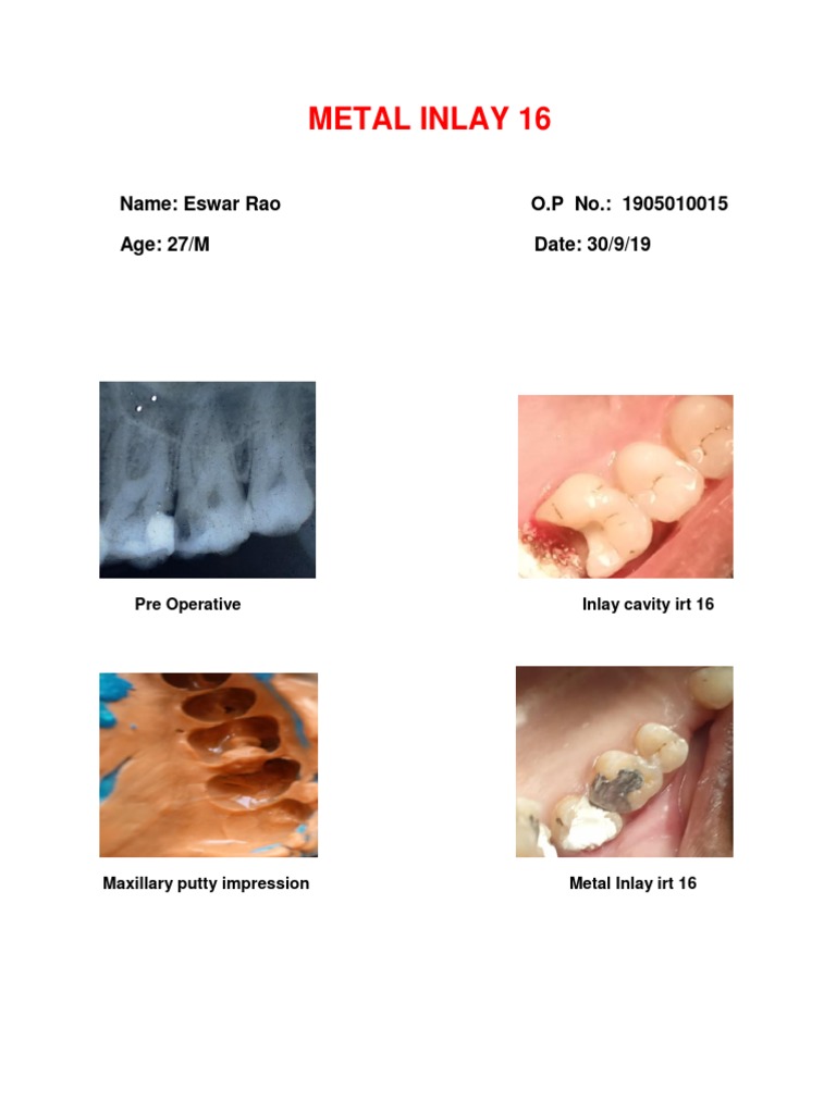 Eswar Rao 26 PDF | PDF