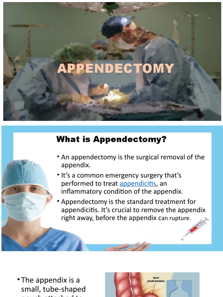 Appendectomy: Procedure & Care Guide | PDF | Ct Scan | Medical Imaging