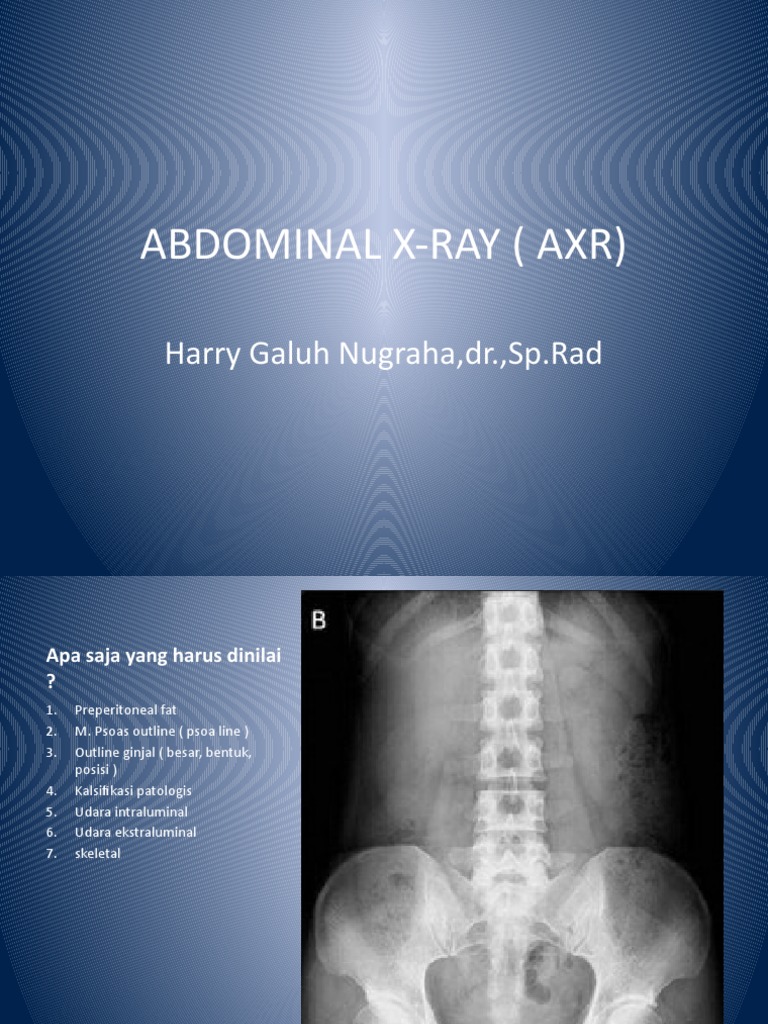 Abdominal X-Ray (Axr) | PDF