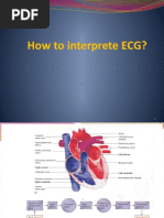 ECG Rhythm Analysis - Life in The Fast Lane ECG Library | PDF | Computers