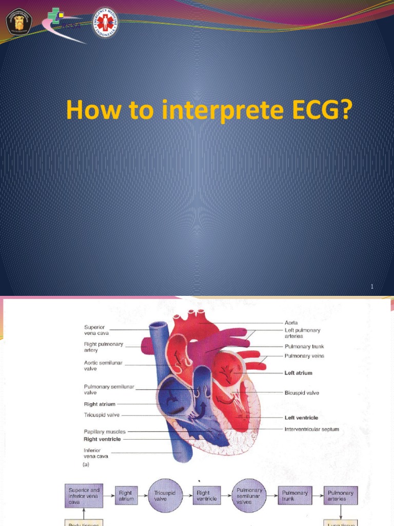 Interpretase Ekg Ali Haedar | PDF | Electrocardiography | Medical Imaging
