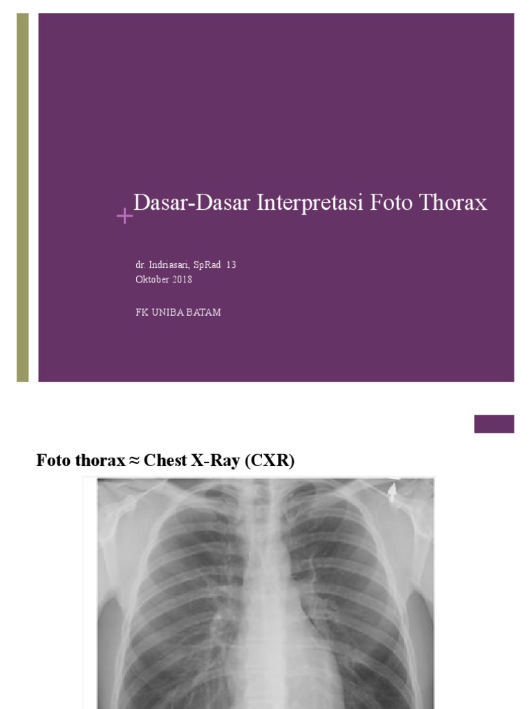 Dasar Interpretasi Foto Thorax CXR | PDF