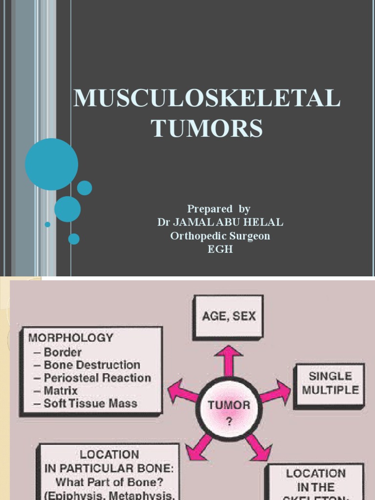 Musculoskeletal Tumor Classification Guide | PDF | Biopsy | Bone
