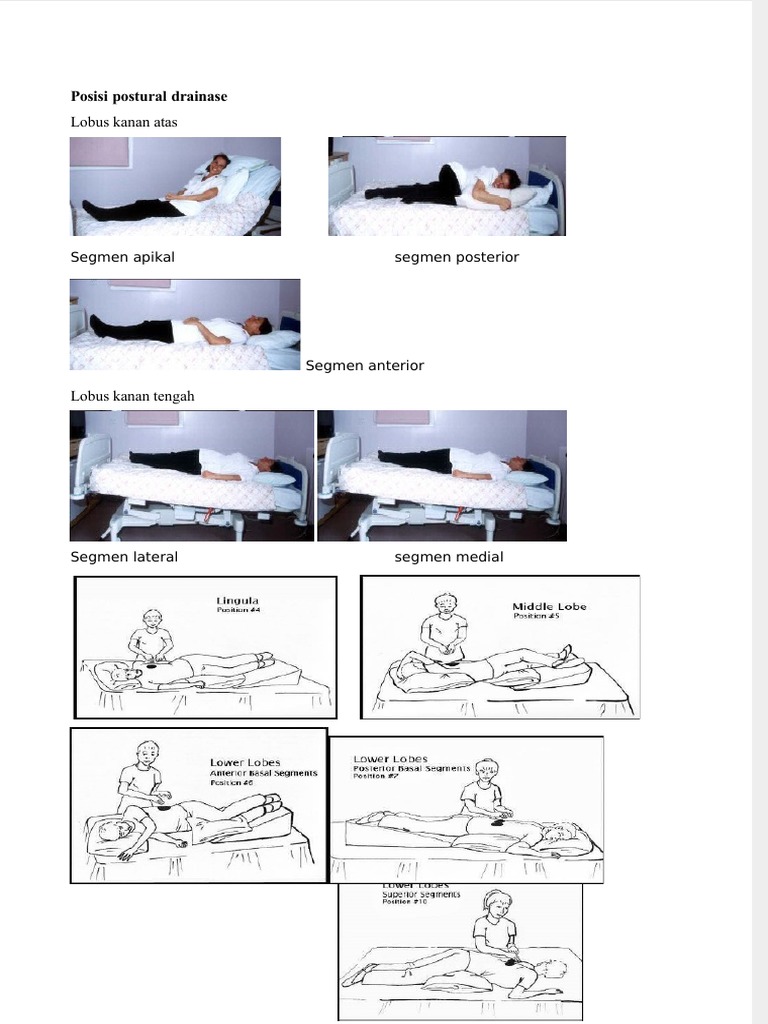 Postural Drainage Positions for Effective Lung Care | PDF