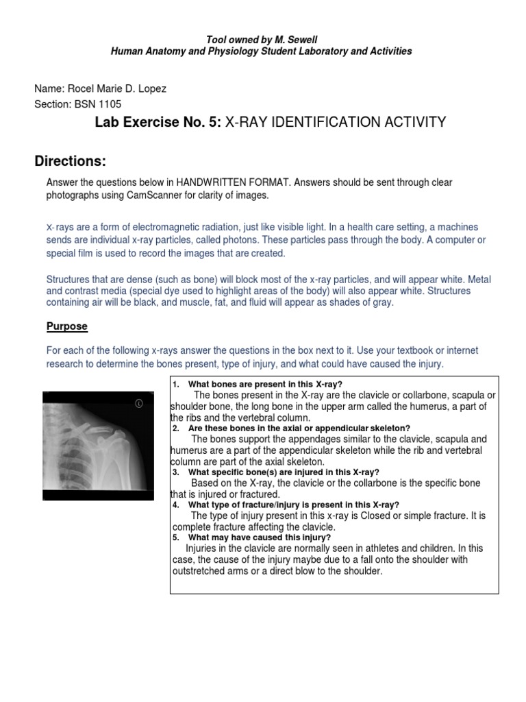 Lab Exercise No. 5: X-Ray Identification Activity: Name: Rocel Marie D ...