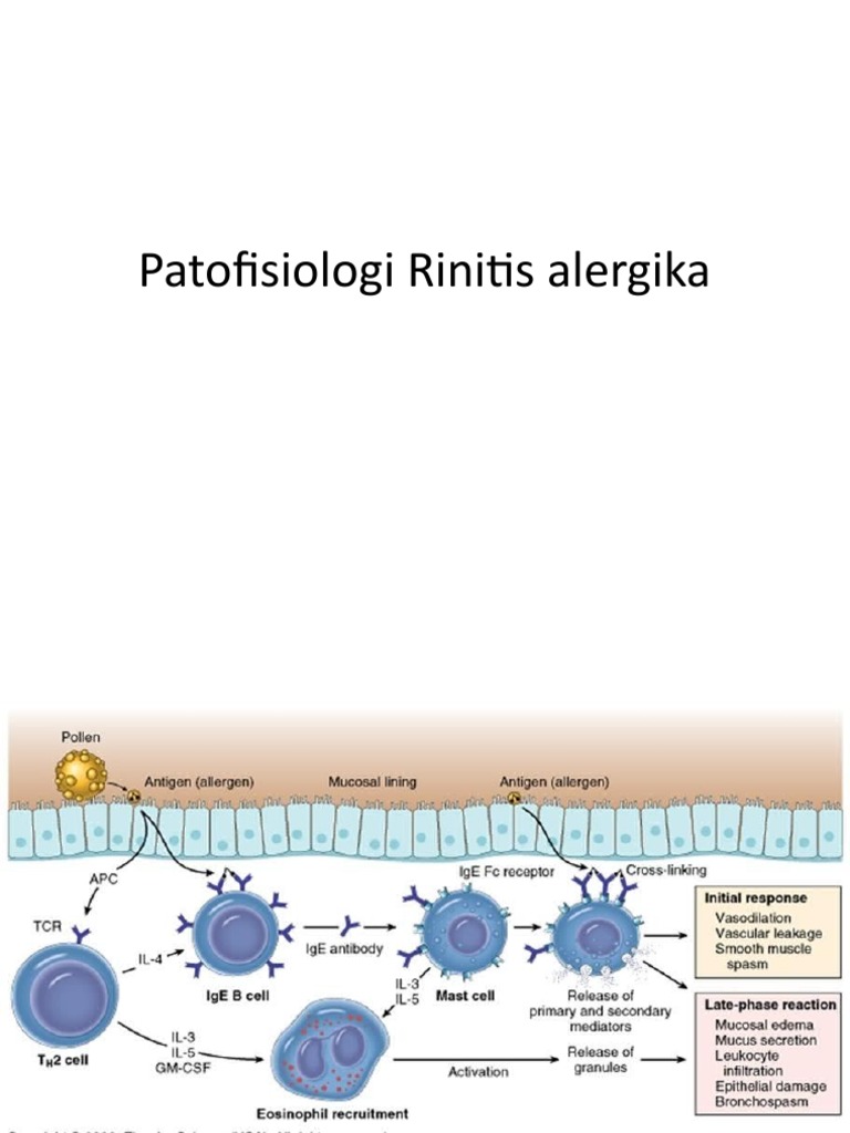 Patofisiologi Rinitis Alergika | PDF