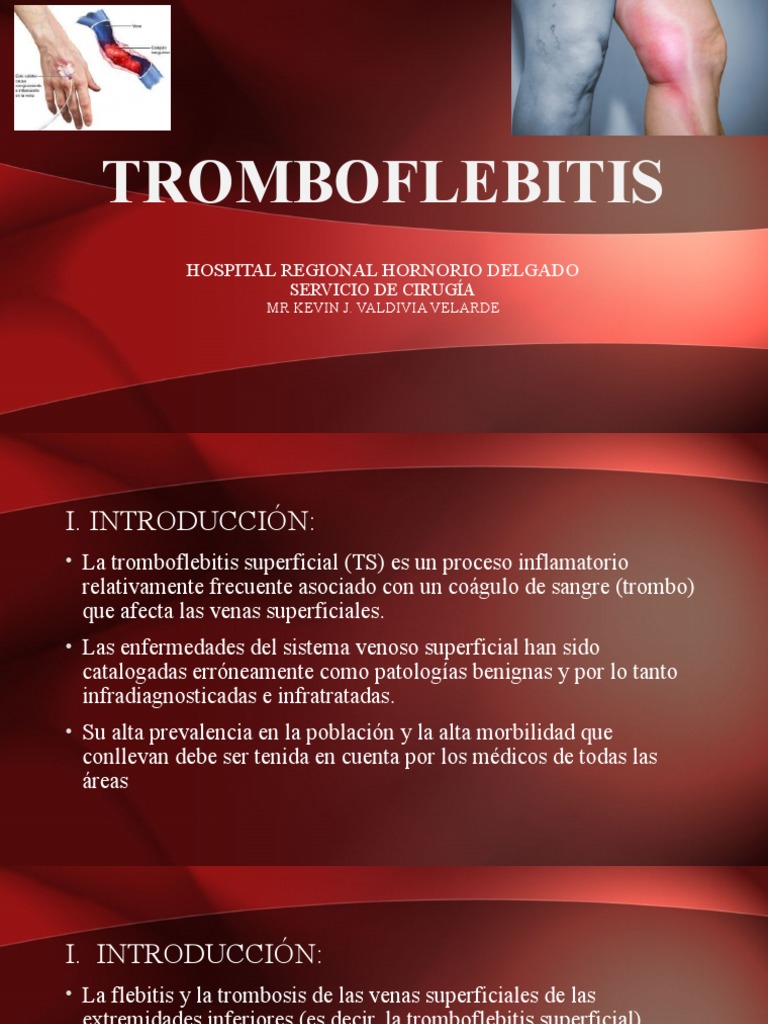 TROMBOFLEBITIS | PDF | Trombo | Droga anti-inflamatoria libre de esteroides