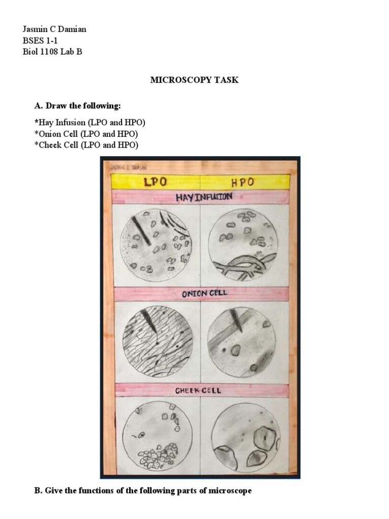 Microscopy Task A. Draw The Following: Hay Infusion (LPO and HPO) | PDF ...