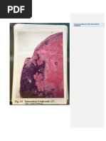 Coduri diagnostice pentru concediu medical | PDF