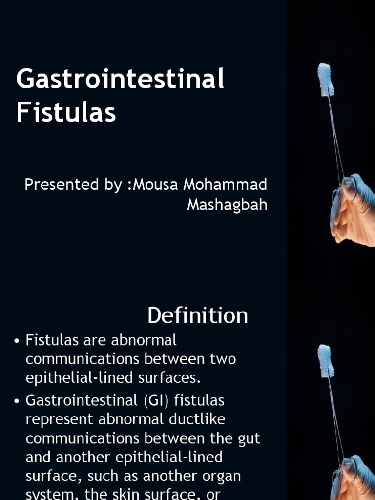 Gastrointestinal Fistulas - Mousa Mashagbah | PDF | Gastrointestinal ...